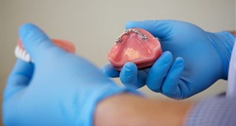 Qu'est-ce qu'un implant? - Benoit Viau Denturologiste